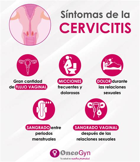Cervicitis Crónica La Inflamación Que Afecta A Muchas Mujeres Sin Que