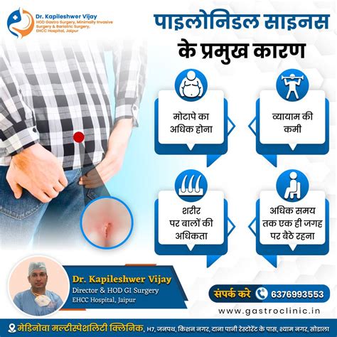 Pilonidal Sinus Causes Dr Kapileshwer Vijay Gastro Clinic