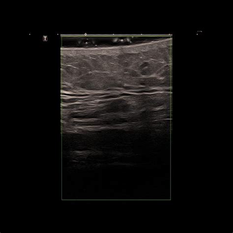 tissue edu instance segmentation dataset by tissuesegmentation