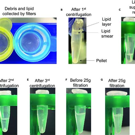 Nuclei Isolation A 100mm Left And 40mm Right Filters After Download Scientific Diagram