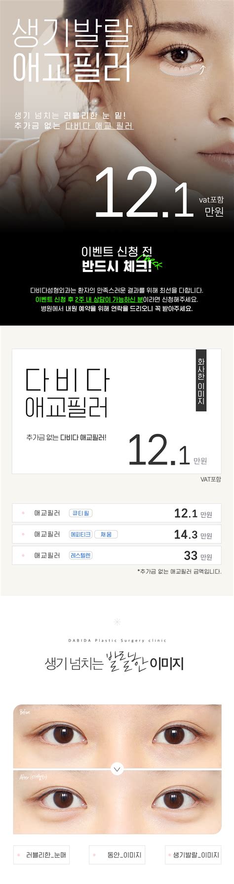 생기발랄 애교필러 By 다비다성형외과의원 강남언니 1등 성형수술and피부시술 정보앱