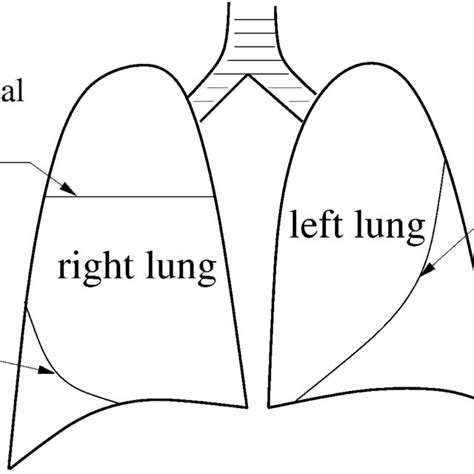 Diagram Of The Lobar Fissure Detection Scheme Detection Is Initialized
