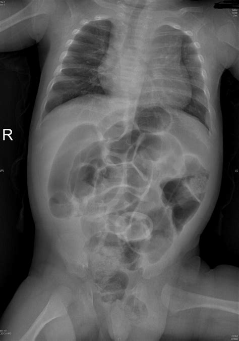 The Pediatric Surgical Abdomen Pediatric Emergency Playbook