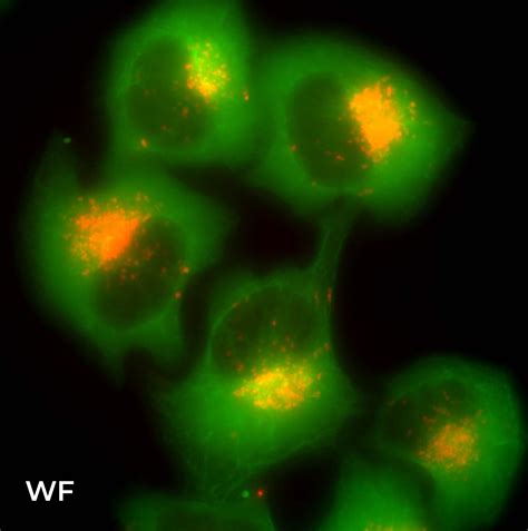 Live Cells Details And Dynamics With Structured Illumination Microscopy