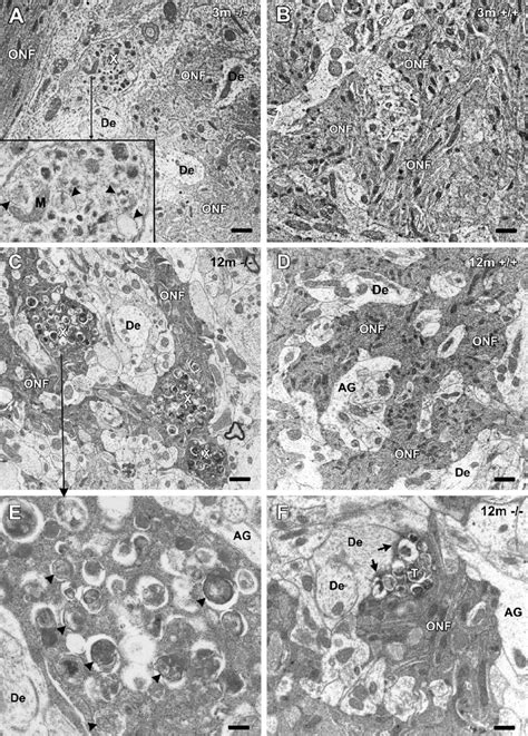 Electron Microscopy Of The Olfactory Bulb Glomeruli In Ccdc66 And