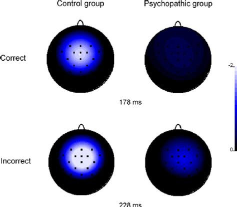 Scalp Topographies Of The Peak Amplitudes Of The Correct And Incorrect Download Scientific