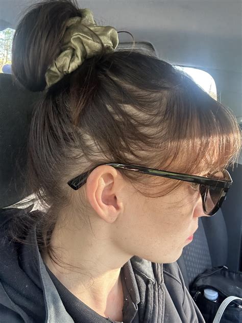 finally seeing some results r femalehairloss