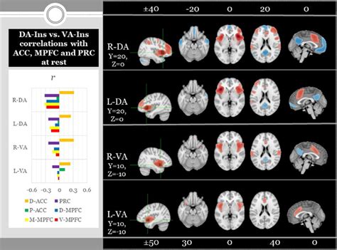 Title Resting State Functional Connectivity Analysis Examining