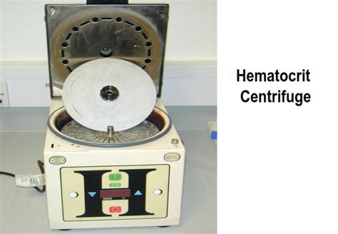 Determination Of Pcv Hematocrit Clinical Pathology And Hemolymphatics