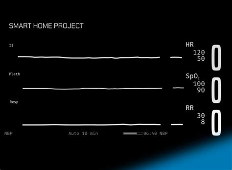 Of IoT Projects Fail Heres What You Could Do To Avoid This Scenario A Blog About The