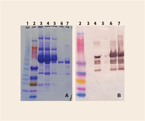 Large Scale Affinity Chromatography