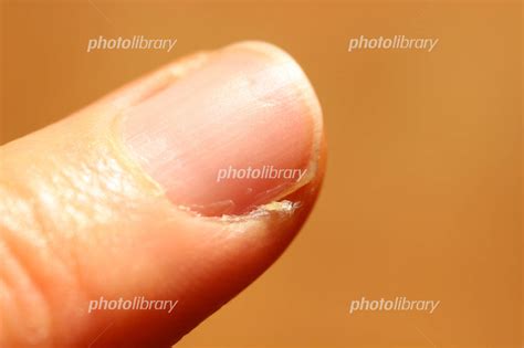 ささくれ 写真素材 4829541 フォトライブラリー Photolibrary