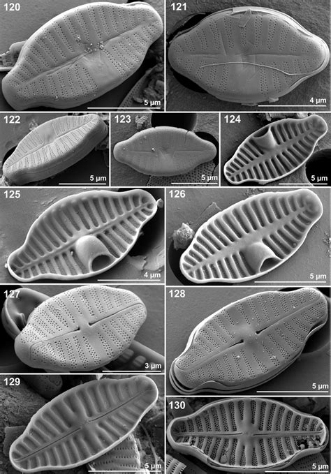 0 Planothidium Rostratoholarcticum Lange Bertalot Et Bąk In Bąk