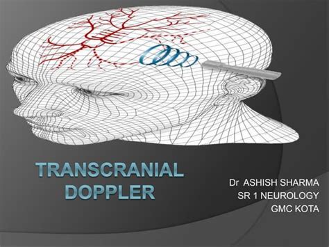 Transcranial Doppler 1 Pptx