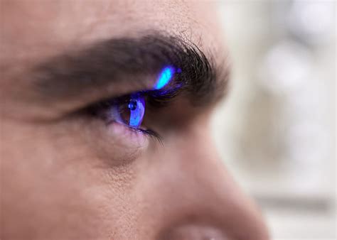 The Complete Guide To Lasik Eye Surgery 2024 Edition
