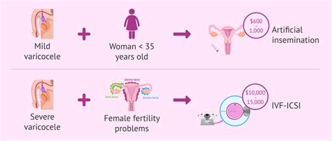 Fertility Treatment According To The Degree Of Varicocele