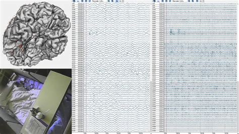 Gtec Medical Engineering Gmbh On Linkedin Gtecsuite2020 Ghisys