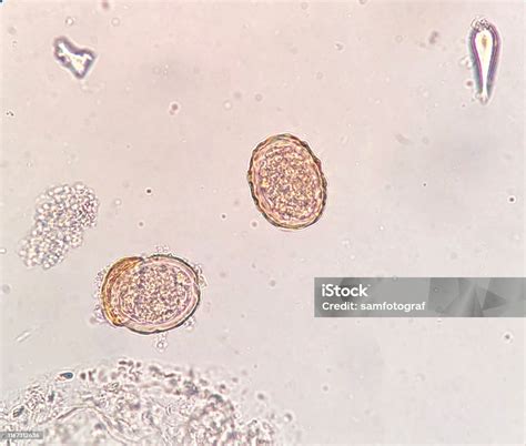 Roundworm Under Microscope Theyd Rather Die The Lesson That Male