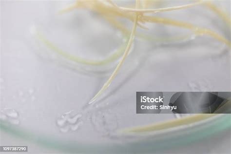 Ascariasis Adalah Penyakit Yang Disebabkan Oleh Cacing Gelang Parasit Ascaris Lumbricoides Untuk