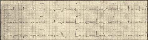 Emergency Medicine News