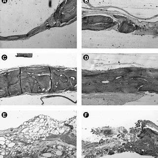 Immunostaining Of The Osteocalcin Protein Among All Groups A And B Download Scientific Diagram
