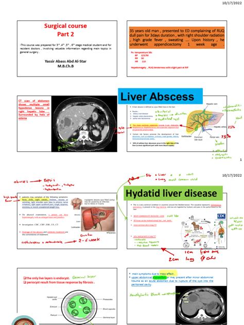 R Abscess Hydiated Cyst Pdf Liver Medicine