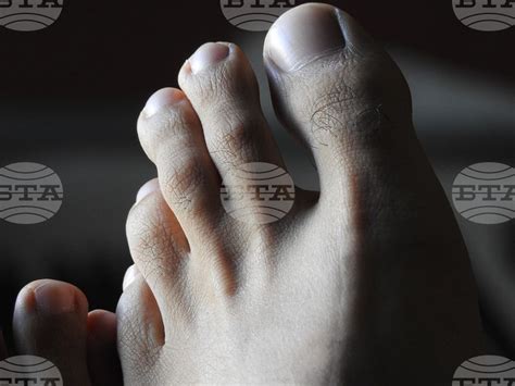 Пръстите на краката са индикатор за висок холестерол установиха учени Утро