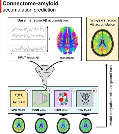 A Breakthrough In The Accuracy Of Prediction Of The Course Of Alzheimers Disease Centre For