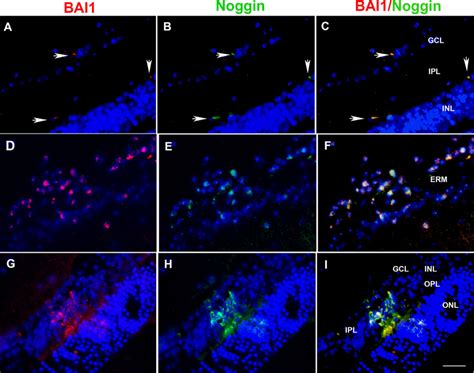 Localization Of Bai1 And Noggin In Erms And Retina Sections Of Mouse