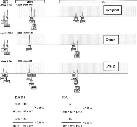 Systematic Analysis Of Stutters To Enhance The Accuracy Of Chimerism