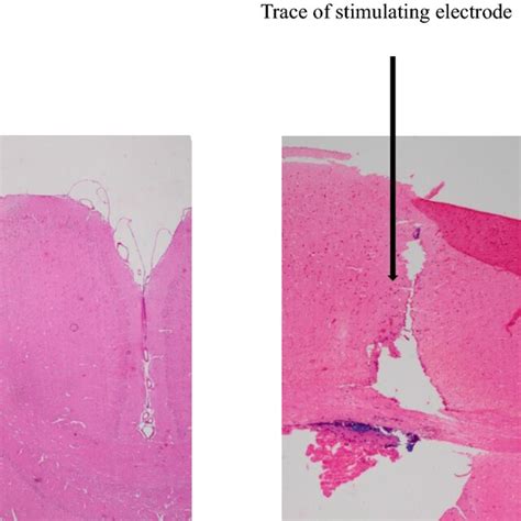 Exemplary Photomicrograph Illustrating Places Of Stimulating And