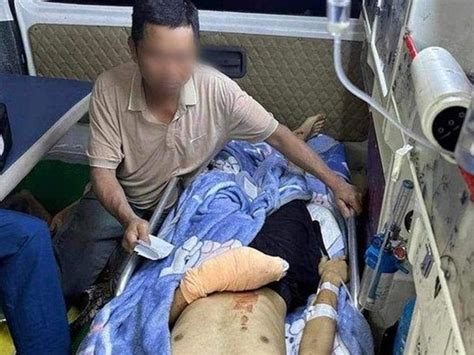 Nam Sinh 17 Tuổi Dập Nát Bàn Tay Tổn Thương Mắt Sau Tiếng Nổ Lớn