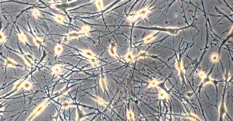 Neuronal Mesenchymal Stem Cells
