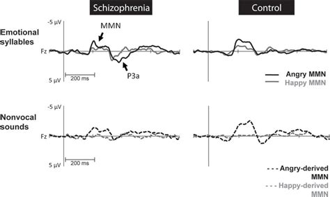 Mismatch Negativity Mmn Amplitudes To Emotional Syllables And