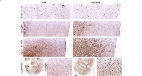 Organotypic Brain Slice Cultures Maintain Characteristic Features Of