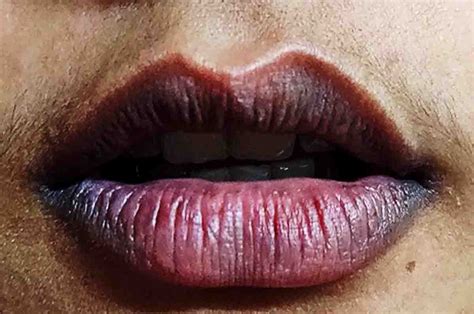 Ini Dia 7 Bahan Alami Untuk Cara Menghilangkan Bibir Hitam Dengan