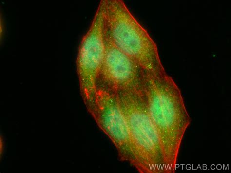 Cdk7 Antibody 27027 1 Ap Proteintech