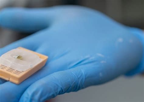 Bioecho Présente Le Kit Darn Echolution™ Ffpe Pour Une Extraction Supérieure De Larn Des