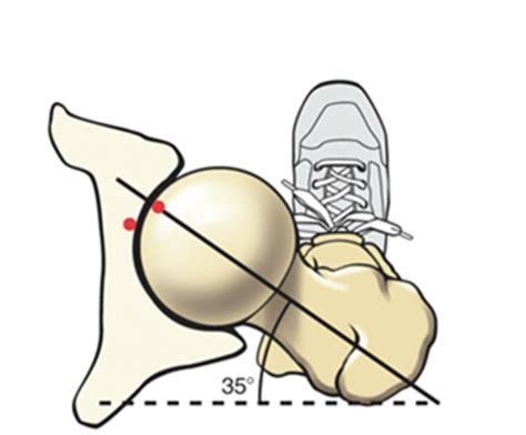 HIP PT Flashcards Quizlet