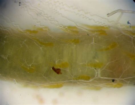 Mystery Organs Of The Stick Insects Solving A Century Old Anatomical