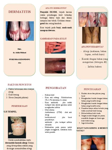 Leaflet Dermatitis Pdf