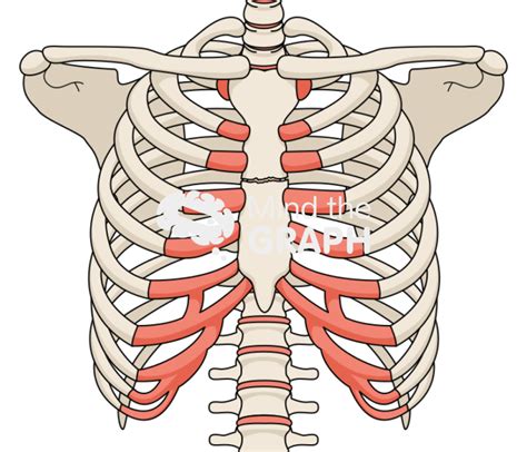 Free Sternal Fracture Icons Symbols Pictures And Images Mind The Graph