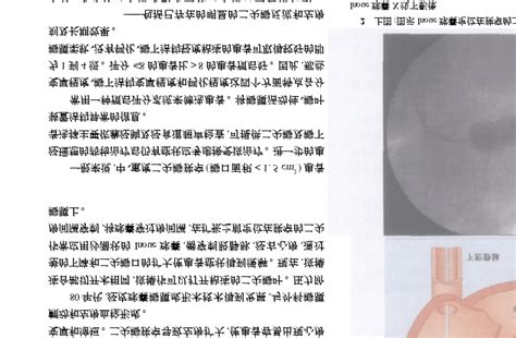 介入心脏病学知识六非冠状动脉经皮介入治疗 word文档在线阅读与下载 免费文档