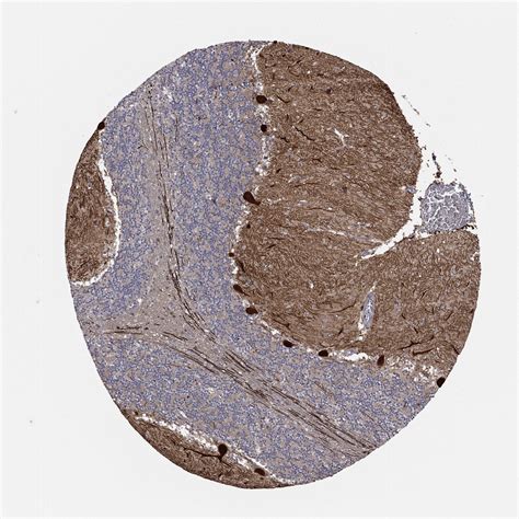 Brain Tissue Expression Of Calb1 In Cerebellum The Human Protein Atlas