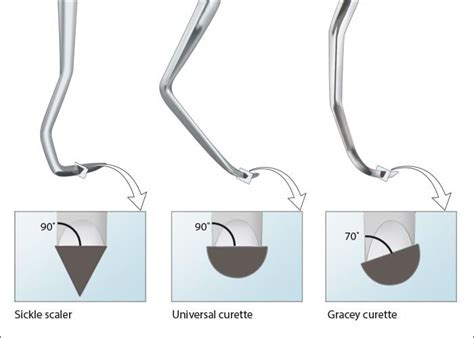 Sharpening Procedure Sharpening Periodontal Instruments Continuing