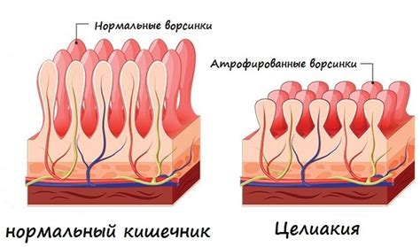 Глютен в спортивном питании
