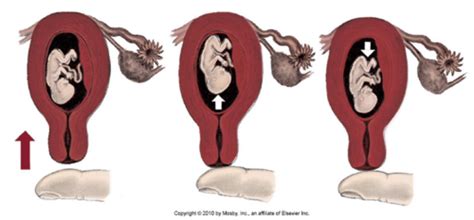 Maternal Adaptation And Nursing Management During Pregnancy Flashcards