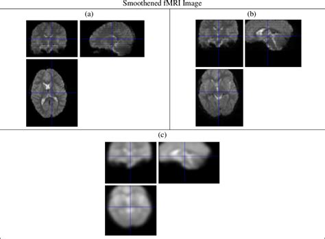 Figure 4 From Classification Of Autism Spectrum Disorder Using Resting
