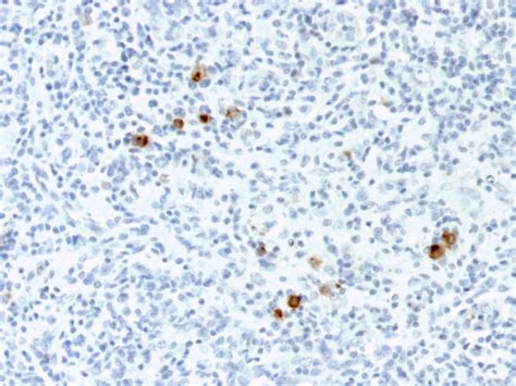 Epstein Barr Virus Lmp 1 Monoclonal Antibody Cs4 Msm5 1744 P0