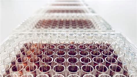 Automation In Proteomics Sample Preparation Danaher Life Sciences